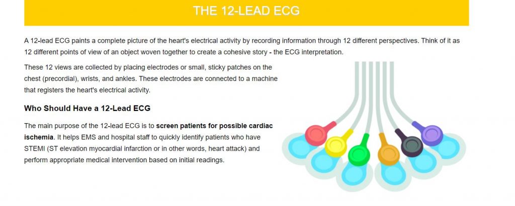 What is an Electrocardiogram? - Phlebotomy Career Training