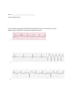 Cardiac-Arrhythmia final exam - Phlebotomy Career Training