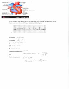 Cardiac Arrhythmia practice answers - Phlebotomy Career Training